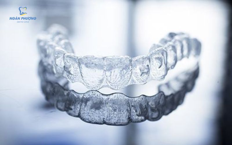 HÀM DUY TRÌ TRONG SUỐT LÀ GÌ? GIÁ HÀM DUY TRÌ TRONG SUỐT LÀ BAO NHIÊU ...